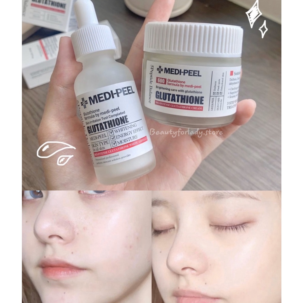 [CHÍNH HÃNG] SERUM VÀ KEM DƯỠNG TRẮNG DA MEDIPEEL GLUTATHIONE 600 WHITE ...