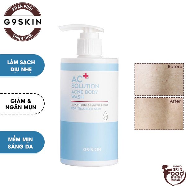 Sữa Tắm Dành Cho Da Mụn G9Skin AC Solution Acne Body Wash 300g | Shopee ...