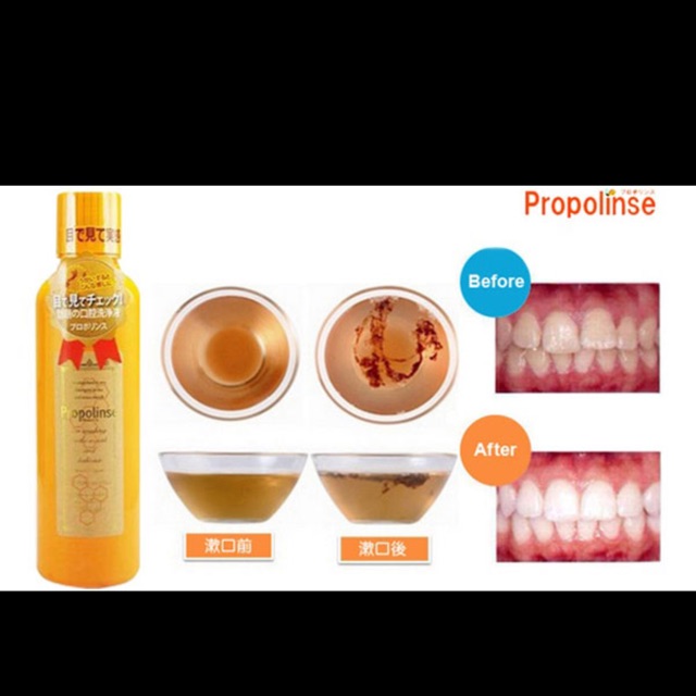 NƯỚC SÚC MIỆNG PROPOLINSE 600ML - NHẬT BẢN | Shopee Việt Nam