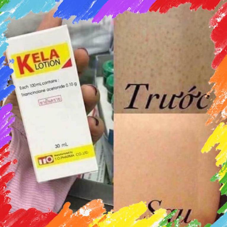 Chính Hãng 🌱 Kela Lotion Viêm Nang Lông Thái Lan 🇹🇭 | Shopee Việt Nam