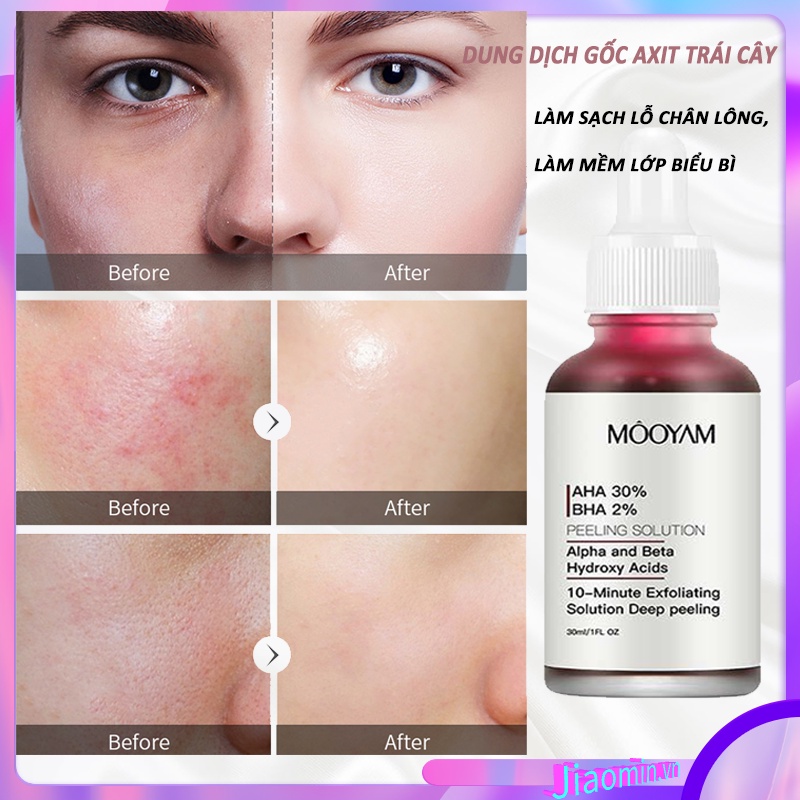 Tinh Chất Axit Hyaluronic 30% + BHA 2% Axit Salicylic Giúp Hỗ trợ giảm ...