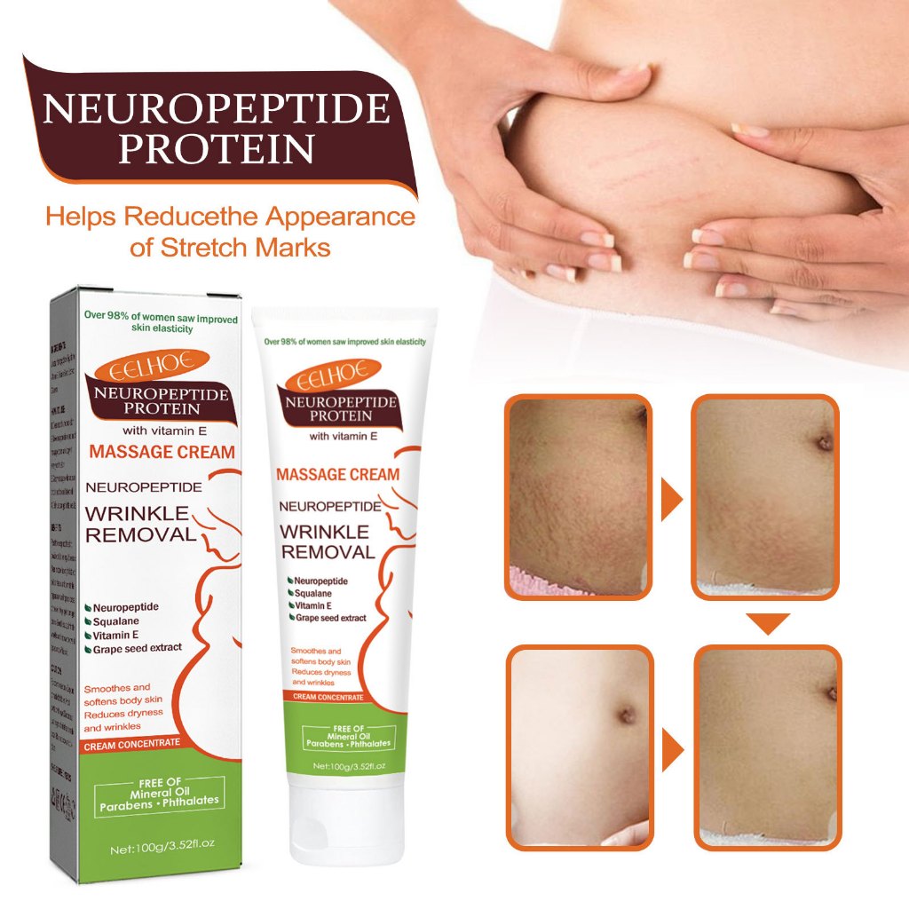 Kem Massage Protein Eelhoe Neuropeptide Làm Sáng Sẹo Mang Thai Và Làm ...