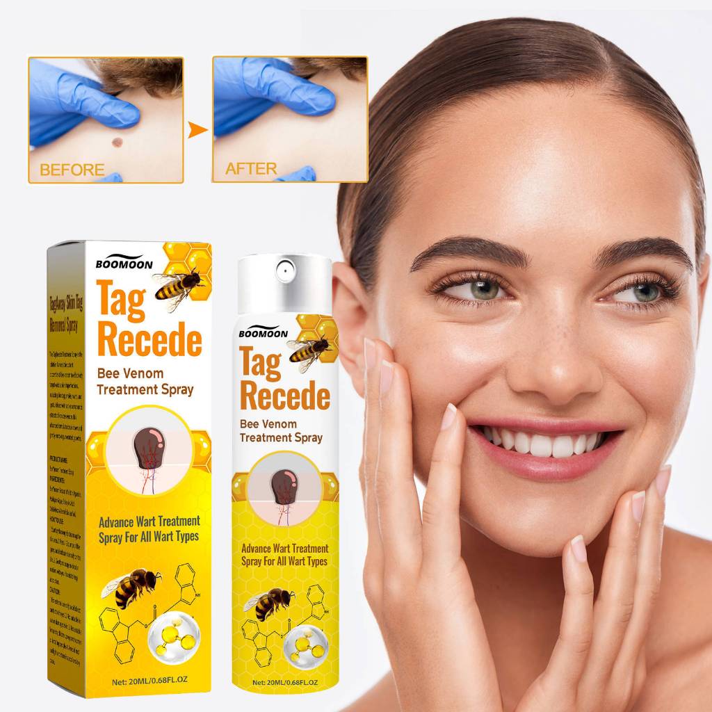 [Còn hàng] 20ml Bee Venom Tag Recede Wart Repair Spray Cải thiện nốt ...