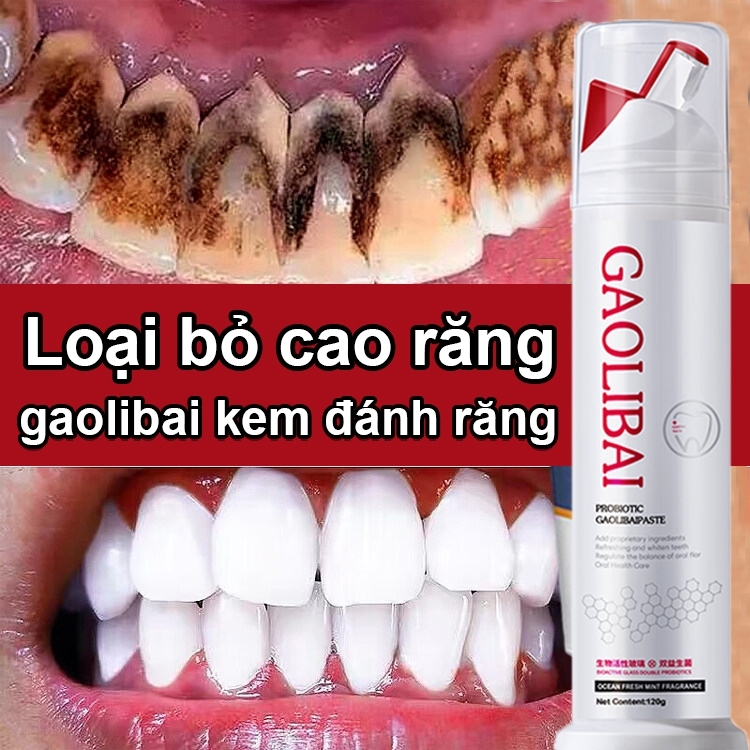 ⭐100%chính hãng⭐kem đánh răng trắng Gel nano bạc kem đánh cao răng ...
