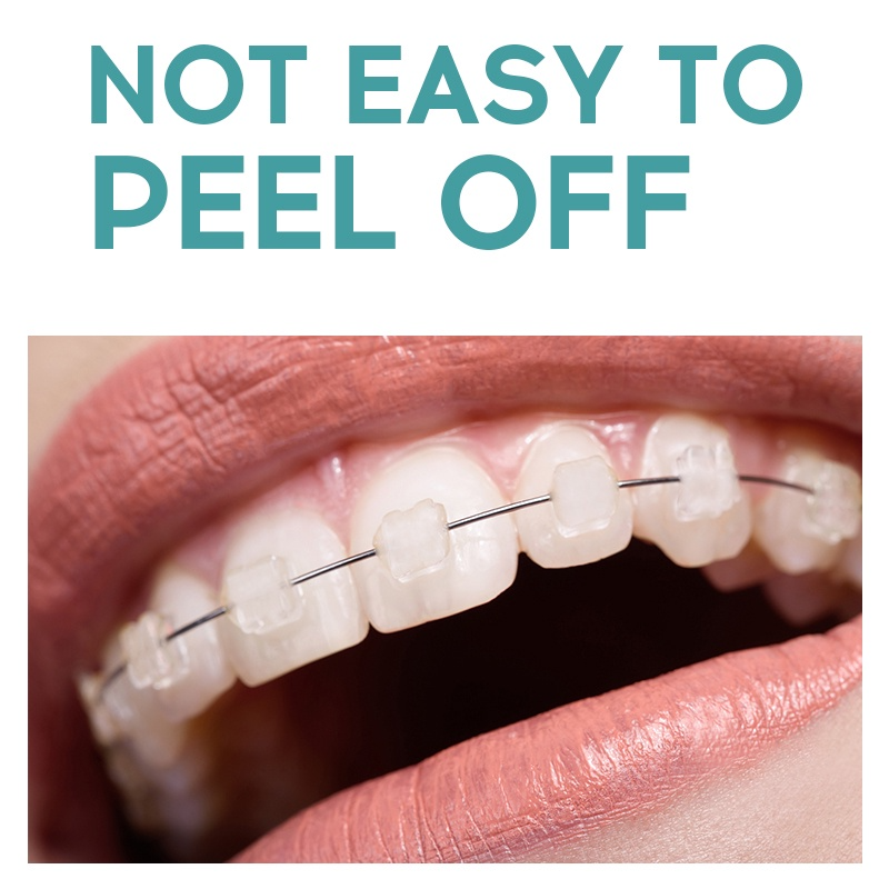 MEYARN Sáp nha khoa hương vị trái cây có vị bạc hà Orthodontic Braces ...