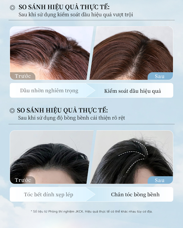 JKCK Chính thức Dầu Gội Kiểm Soát Dầu Chăm Sóc Tóc Dầu Gội Chống Rụng ...