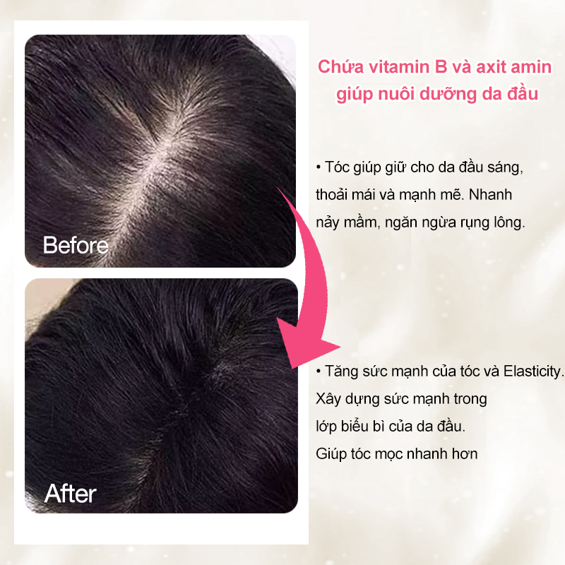【COMBO GIÁ SỐC】Cokki Dầu Gội & Dầu Xả Ngăn Gãy Rụng (900ml + 500ml ...