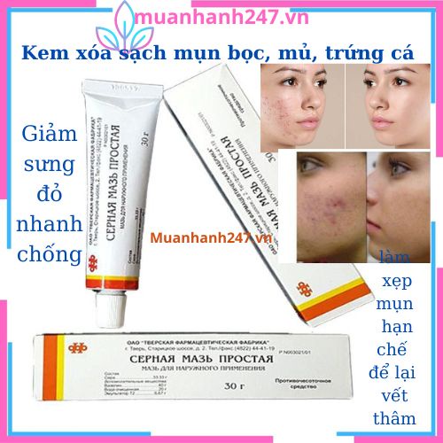 Kem Lưu Huỳnh Cephar Chấm Mụn Bọc Mủ Trứng Cá Mỡ Lưu Huỳnh Mụn Nga