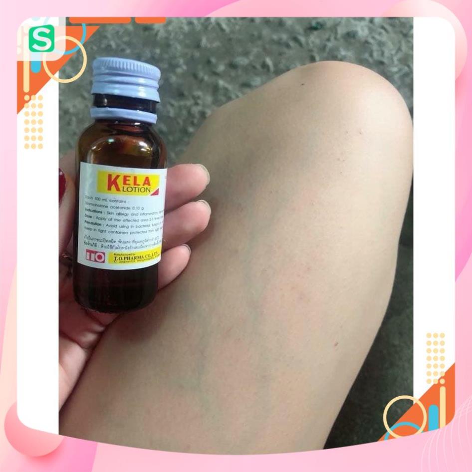 Viêm lỗ chân lông Thái Lan Kela lotion 60ml | Shopee Việt Nam