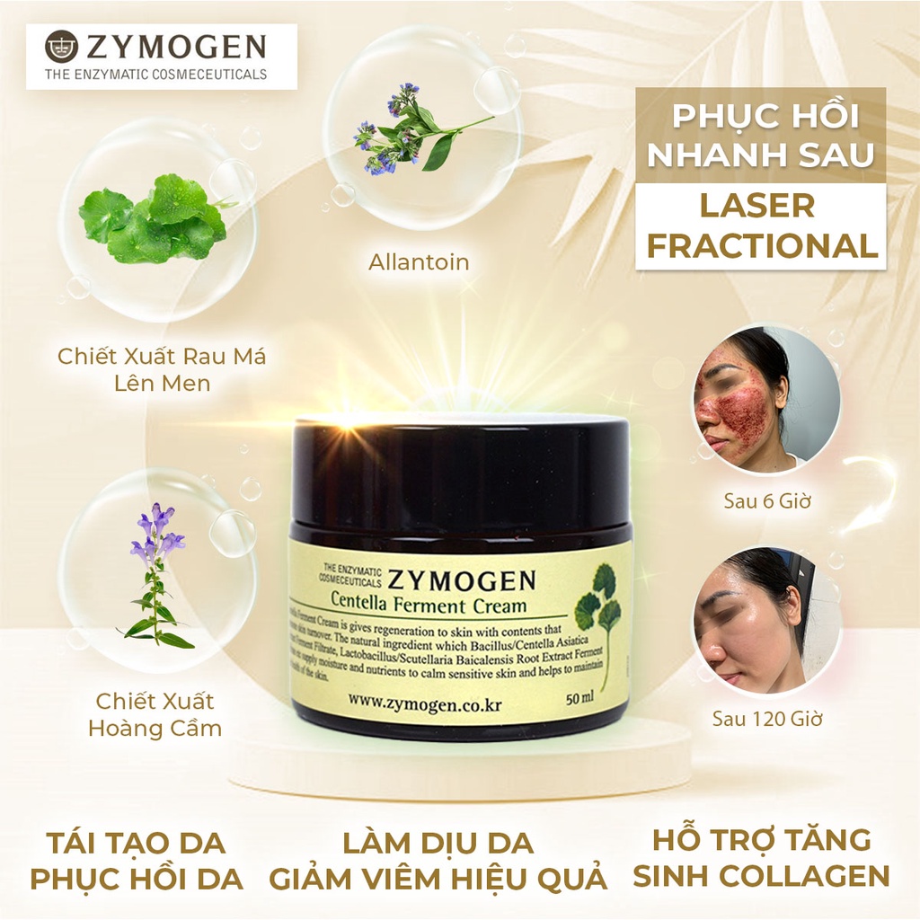 [Nhập khẩu] Kem dưỡng ZYMOGEN rau má lên men cho da mụn, treatment 50ml ...