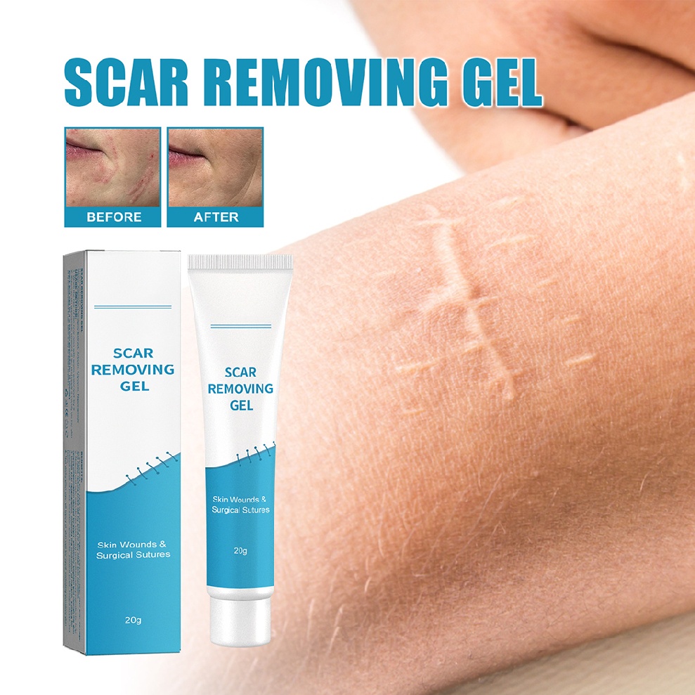 Scar Removing Gel Acne Scar Treatment Skin Wounds Surgical Scars Repair ...