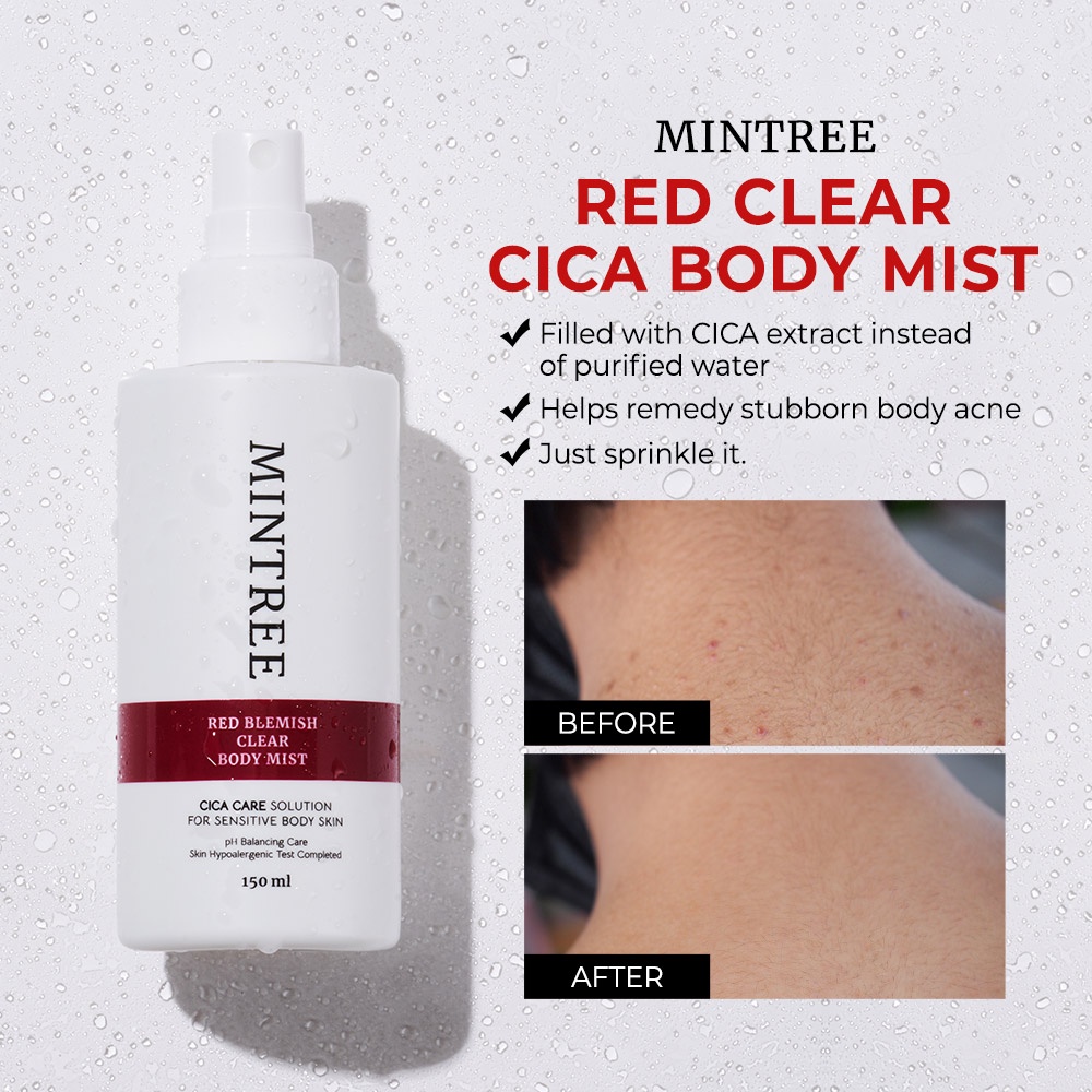 [Mintree] Red Blemish Back Acne Clear Body Spray-150ml*1EA,Korea ...