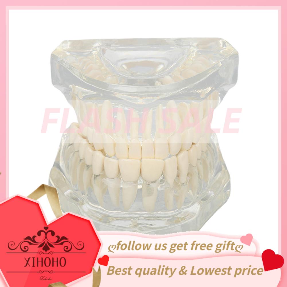 Xihoho Transparent Dental Model Clear Structure Educational Display ...