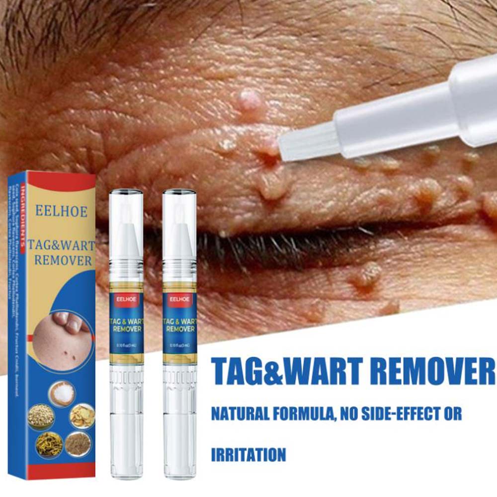 EELHOE 2PC 12 Hours Wart Remover Pen Skin Tag Mole Remover Eliminate ...