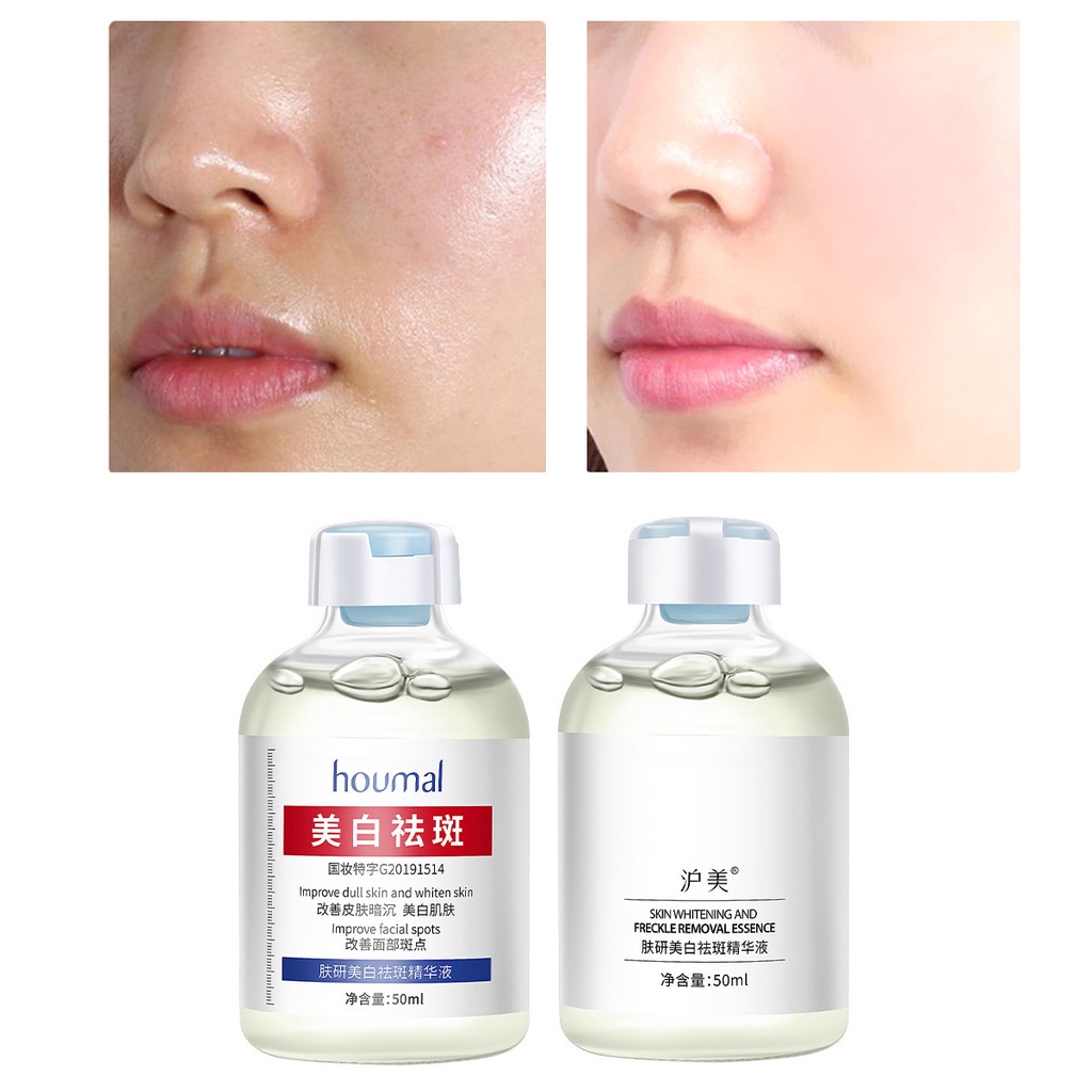 Houmal niacinamide Tinh Chất Làm Trắng Cải Thiện Đốm Đen Trên Da Mặt ...
