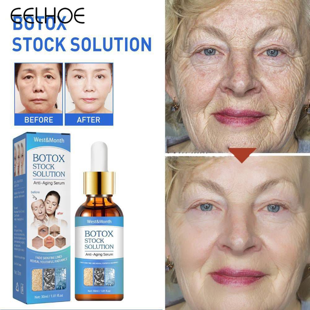 Botox serum Dưỡng Da Mặt Chống Lão Hóa 30ml | Shopee Việt Nam