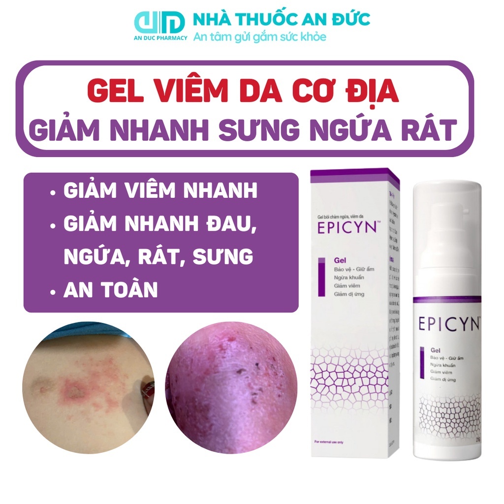 EPICYN - Gel bôi viêm da cơ địa, chàm ngứa, dị ứng, viêm da tiết bã ...