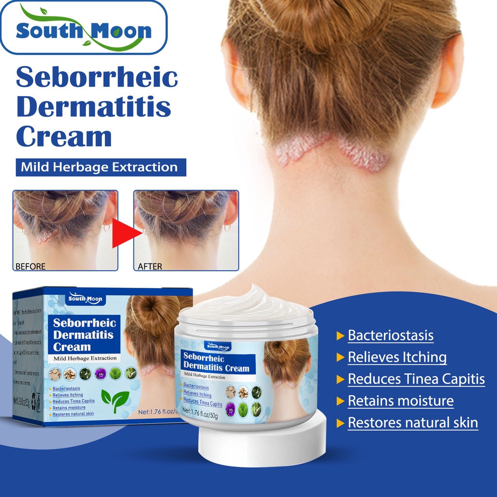 Hot Sale# South moon seborrheic skin cream head acne pruritus psoriasis ...