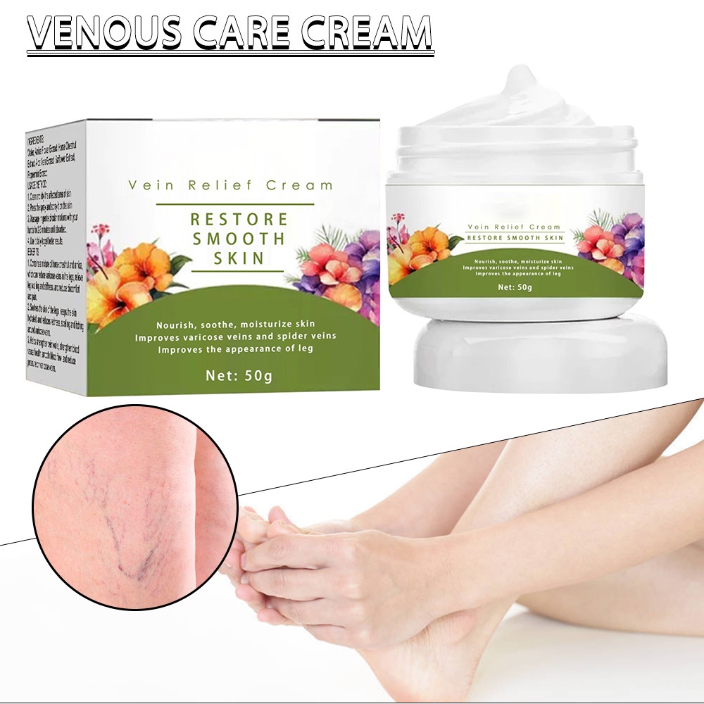 Varicose Vein Relief Cream for Vasculitis Phlebitis Spider Leg Ointment ...