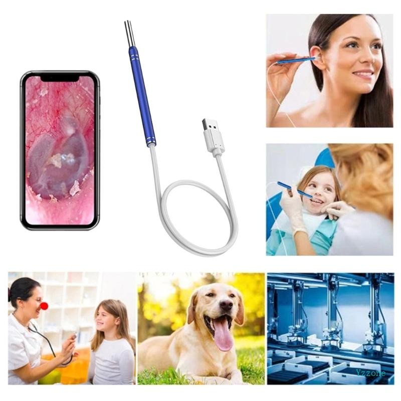 Youdo Ear Cleaner Otscope Ear Wax Remover Tool với 6 LED Ear Endoscope ...