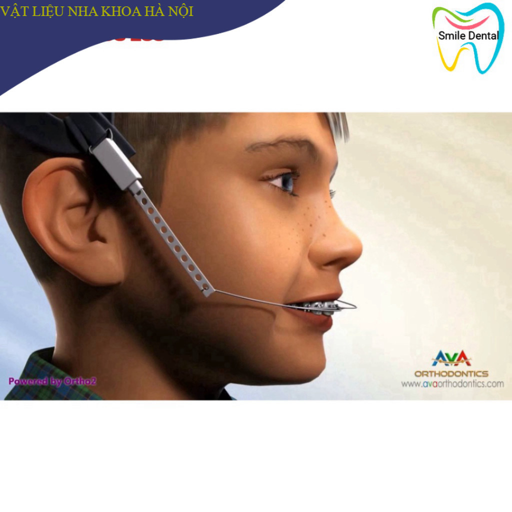 Bộ dụng cụ giảm cân chỉnh nha Headgear-Bộ Chỉnh nha khớp cắn ngược [ Smile Dental ] | Shopee ...