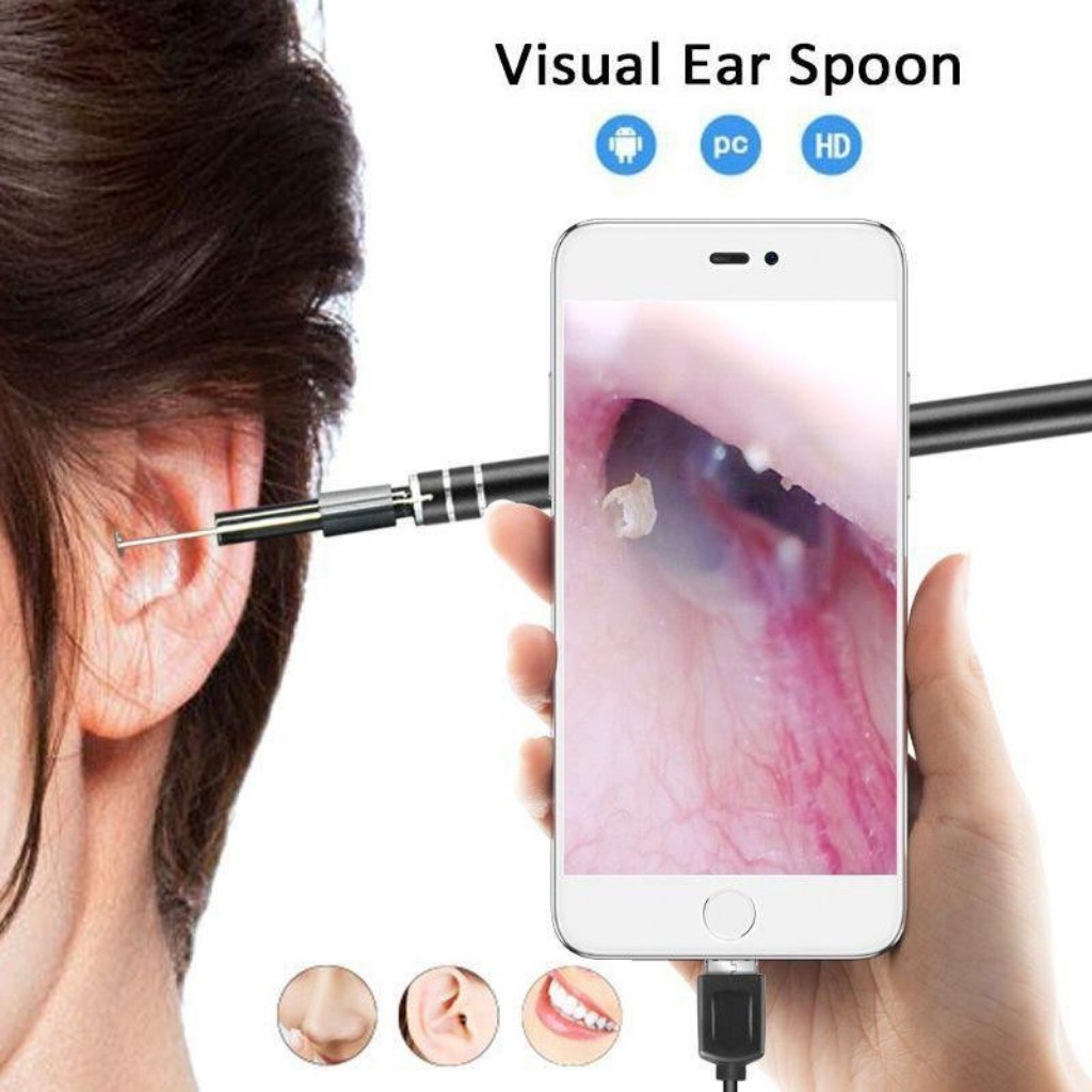 【2025】Dụng cụ lấy ráy tai camera nội soi Ultra HD kết nối điện thoại ...