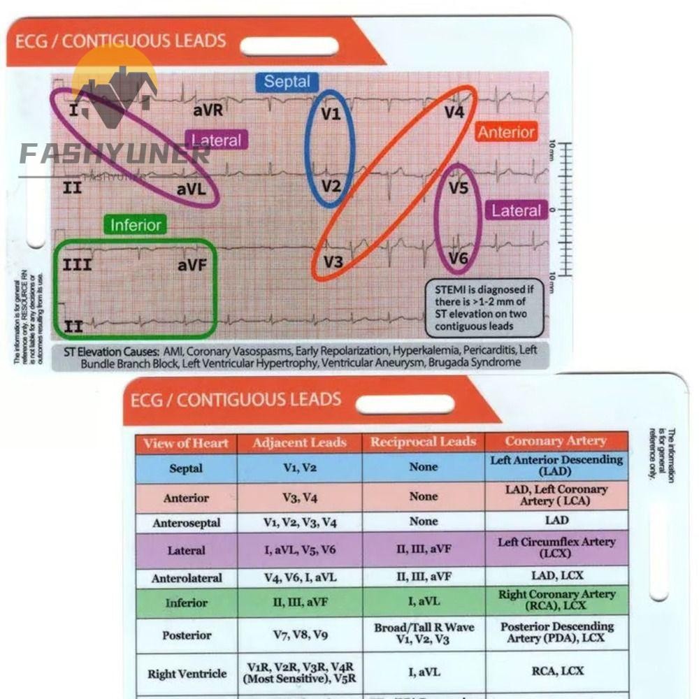 Thước đo 7 bước FASHYUNER ECG, Caliper EKG trong suốt di động, Dụng cụ ...