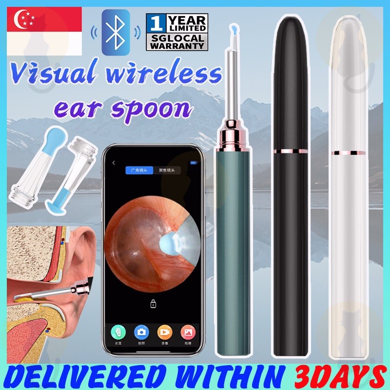 [SG Ready Stock] Smart Visual Ear Picks Ear Cleaner Otoscope Ear Wax ...