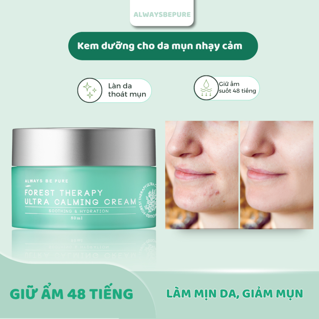 Kem dưỡng làm dịu ngừa mụn ALWAYS BE PURE Forest Therapy Ultra cấp ẩm ...