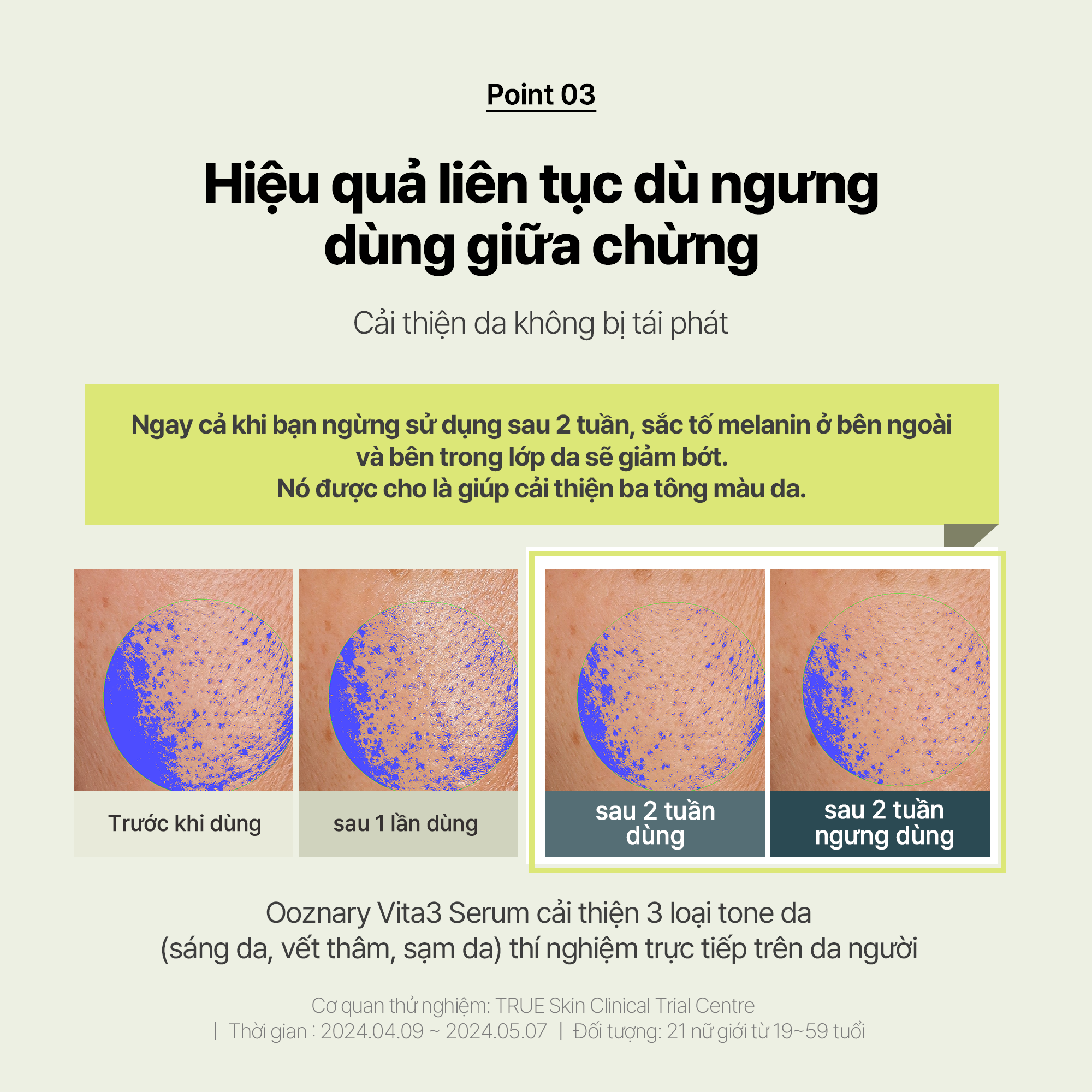 Ooznary Vita3 Serum giúp sáng da mờ thâm, làm dịu da For Blemish Care 50ml | Shopee Việt Nam