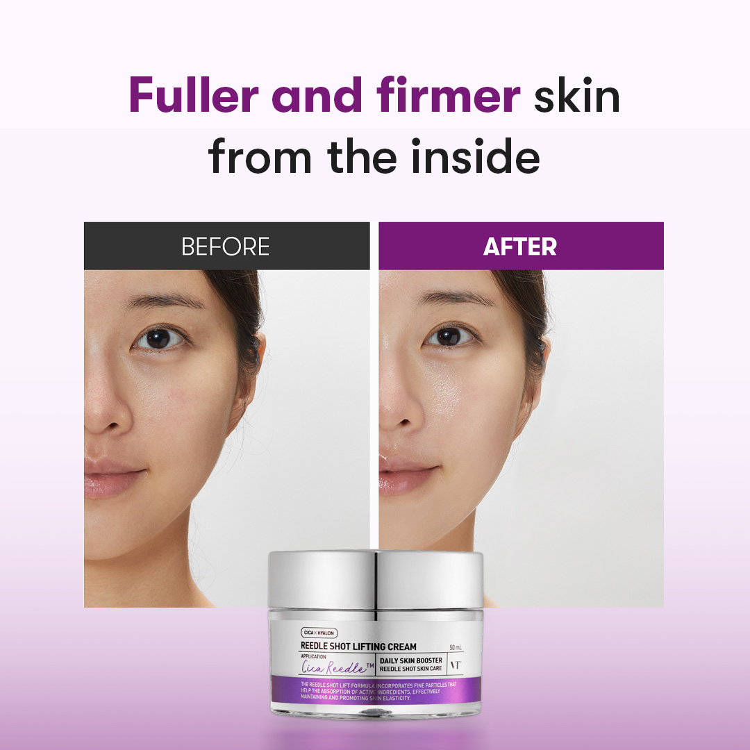 [Vt] Serum nâng Reedle Shot 30ml / Kem nâng cơ Reedle Shot 50ml ...