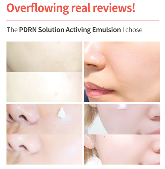 DERMALINE PDRN SOLUTION ACTIVATING EMULSION 200ML | Shopee Việt Nam