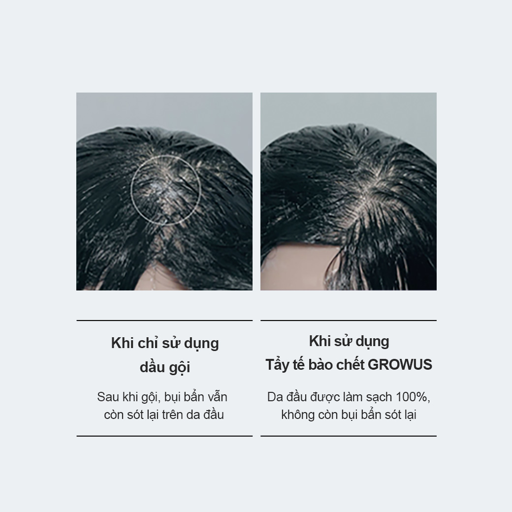 [GROWUS Official] Tẩy tế bào chết da đầu muối biển giảm gàu nhờn GROWUS Sea Salt Therapy Scalp ...
