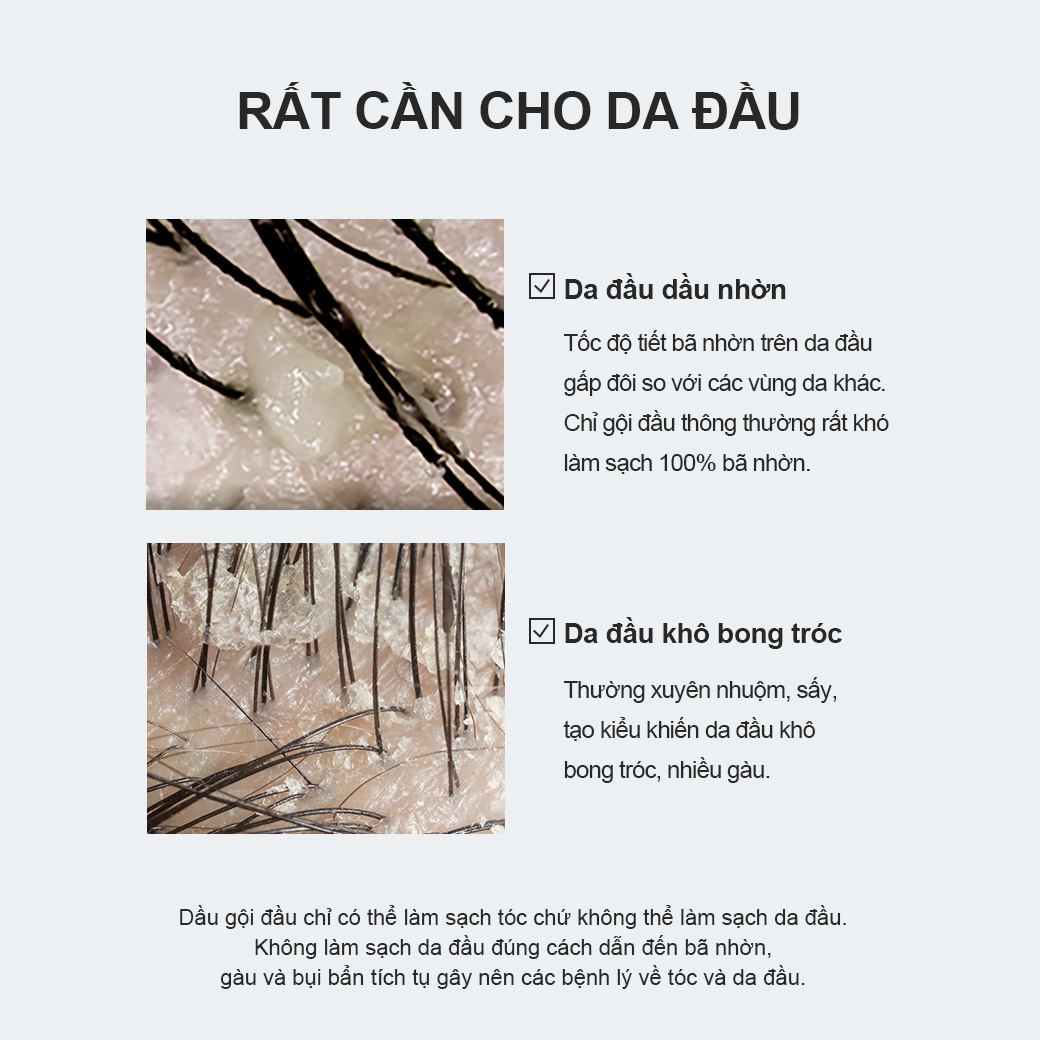 [GROWUS Official] Tẩy tế bào chết da đầu muối biển giảm gàu nhờn GROWUS Sea Salt Therapy Scalp ...