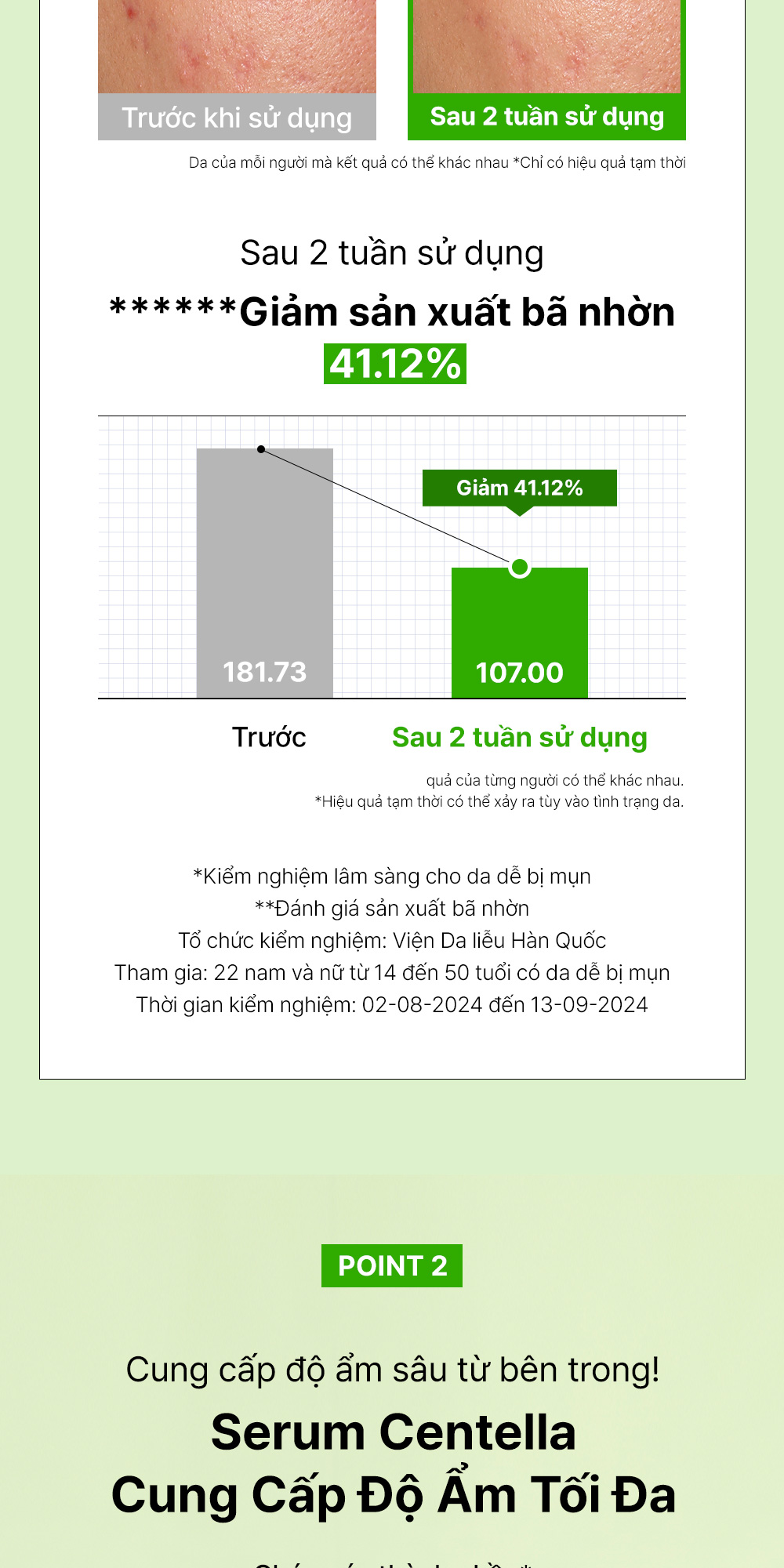 Papa recipe Real Centella Cica Calming Serum (30ml) | Shopee Việt Nam