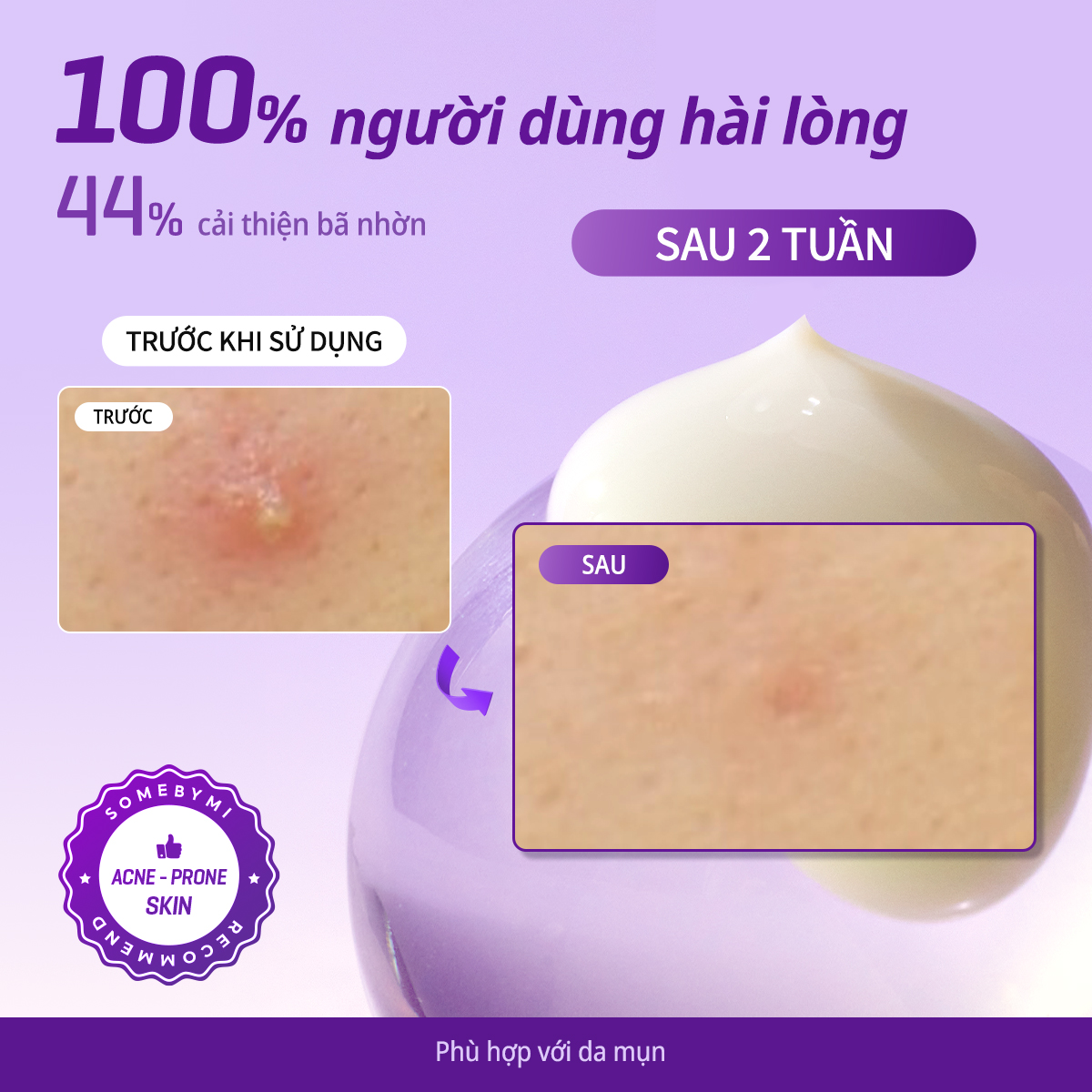 [SOMEBYMI] Bộ đôi Retinol Intense Serum 30ml và Kem dưỡng B5 Hydra ...