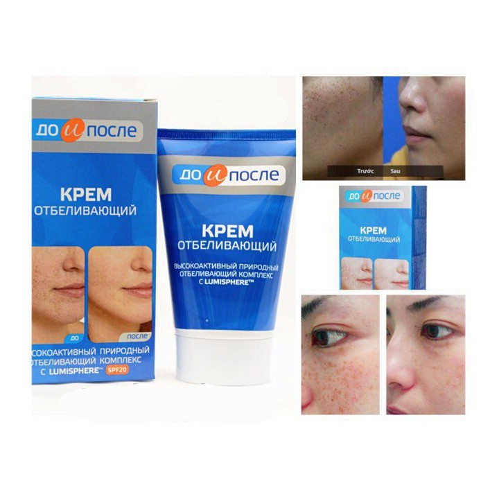 Kem nám Kpem - Nga (100ml) | Shopee Việt Nam