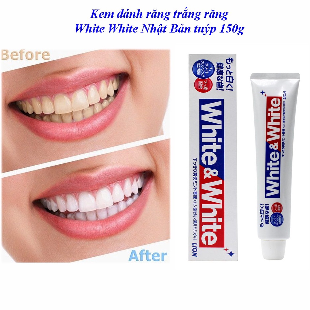 Kem đánh Răng White & White Lion Nhật Bản 150g - MiO Hàng Nhật Nội địa