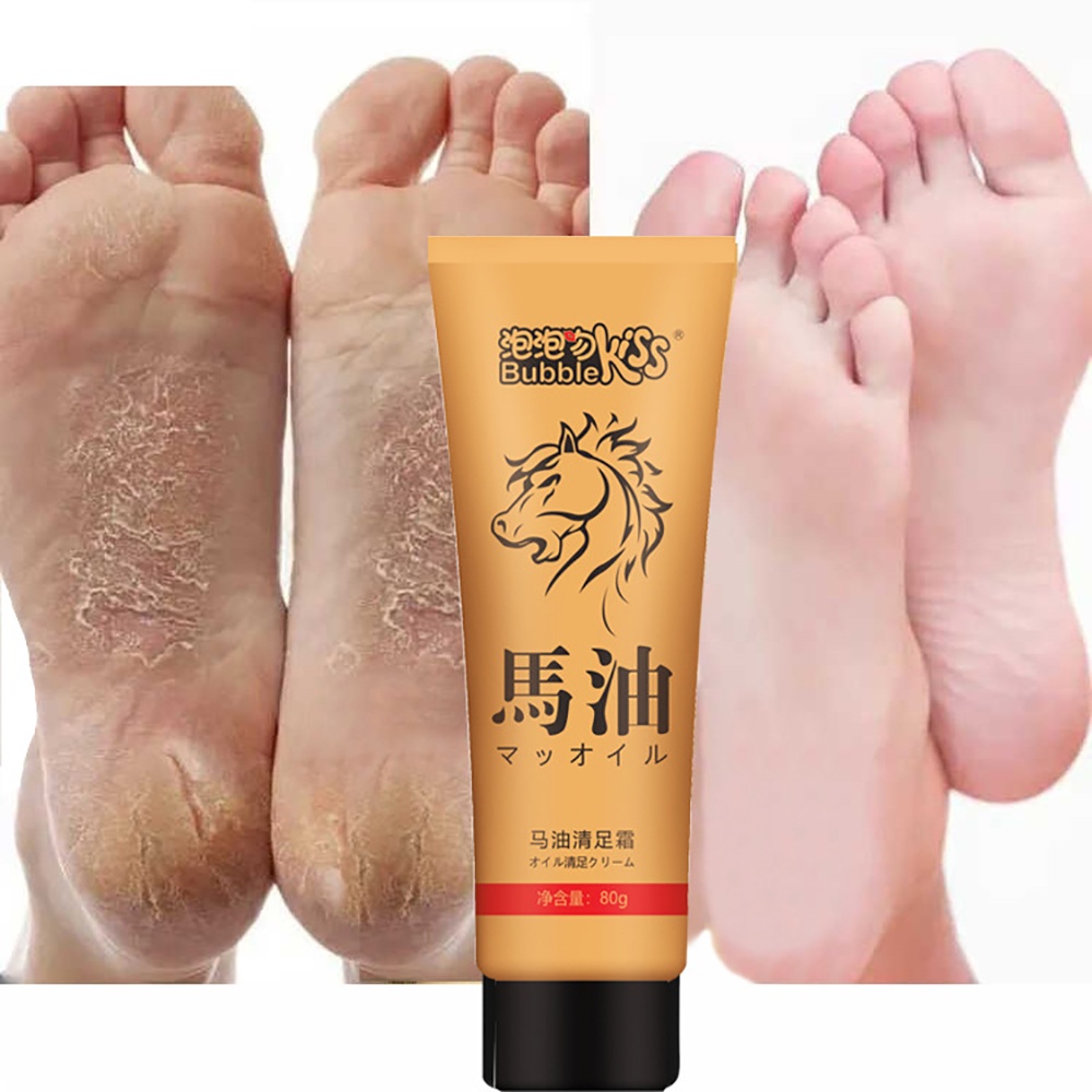 Foot Care Cream Horse Oil Athlete's Foot Itchy Beriberi Treatment Anti ...