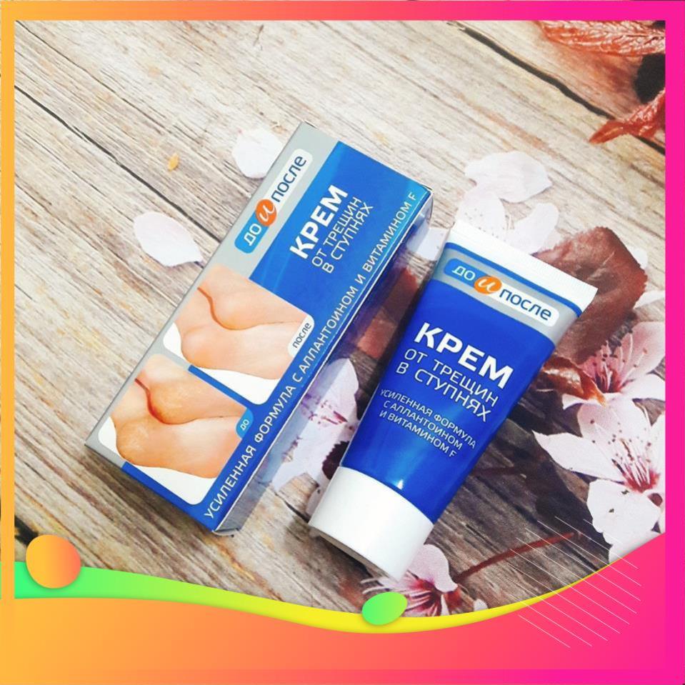 [Chính Hãng] Kem Xóa "NỨT GÓT CHÂN" Nga h | Shopee Việt Nam