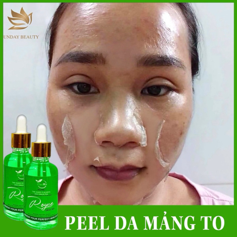 [Peel da] Peel da bong mảng to ROYCE SKIN M+ bóc tách nám tàn nhang sẹo ...