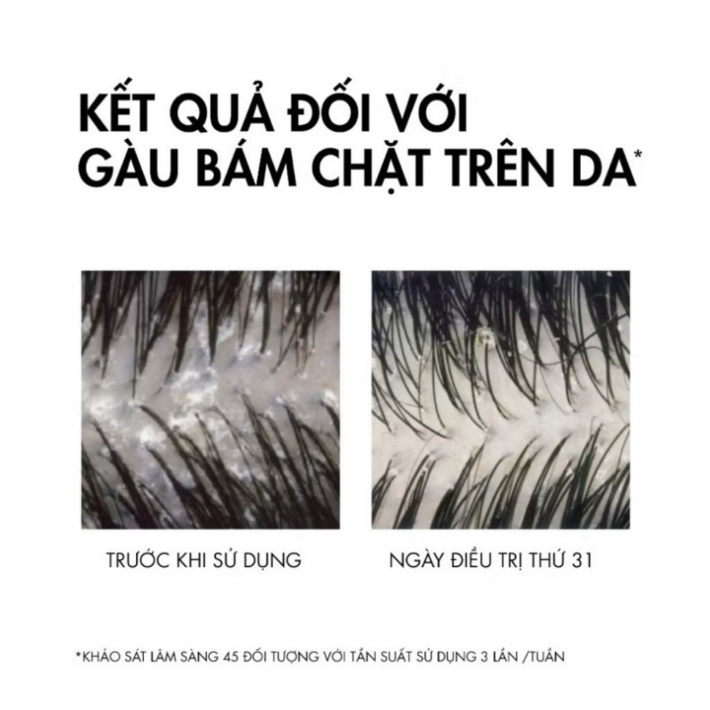 Dầu Gội VICHY Dercos Anti Dandruff Hair Shampoo Sạch Gàu Ngứa Cho Da ...
