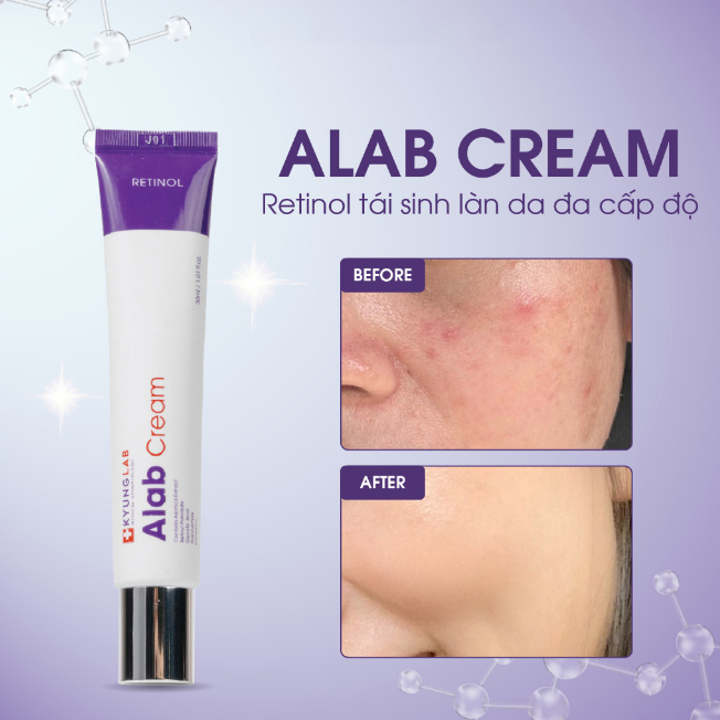 Kyung Lab Kem dưỡng Retinol Alab Cream 30ml | Shopee Việt Nam