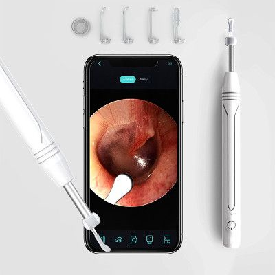Hút Ráy Tai Camera wifi ️không dây ️ 3 trong 1 có đèn LED, Nội Soi Tai ...