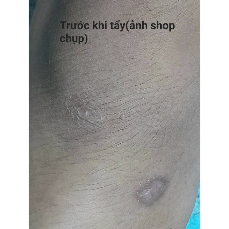 kem tẩy lông hobe bar | Shopee Việt Nam