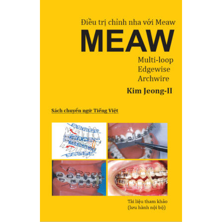 Thư Viện Y Khoa Bạch Mai. Meaw - Chỉnh nha với Meaw (Dây cung thẳng đa ...
