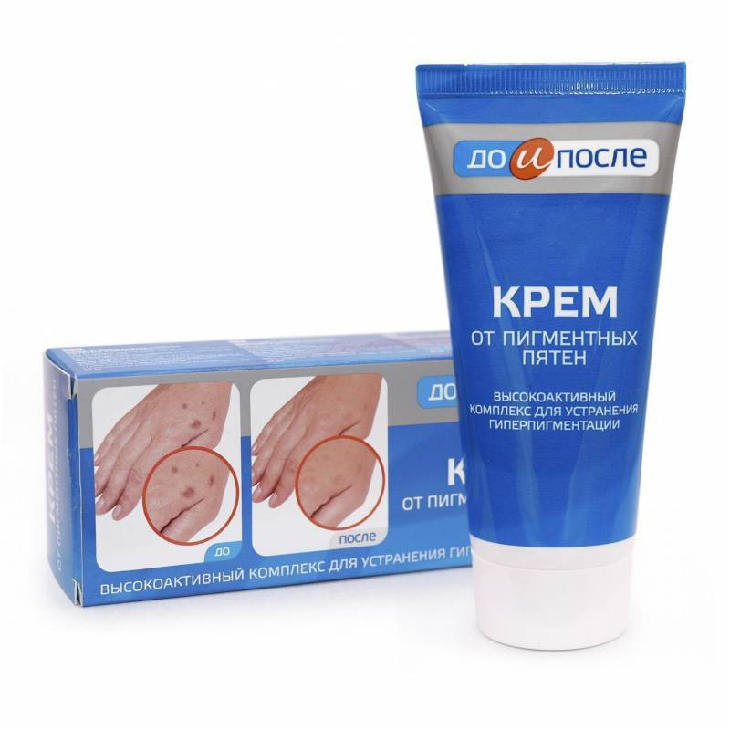 Kem dưỡng da tay đồi mồi Kpem của Nga/50ml | Shopee Việt Nam