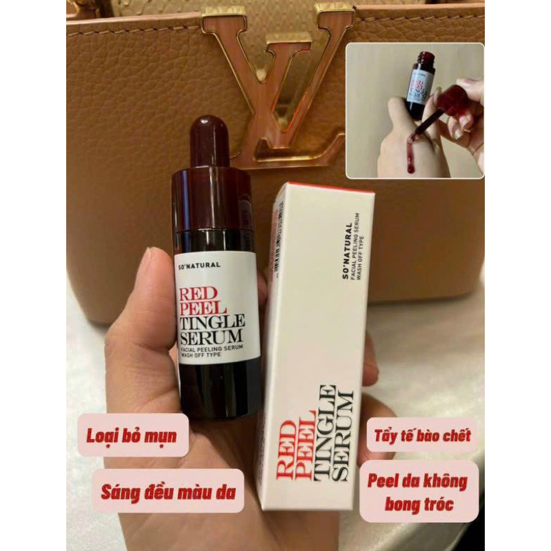 [Mẫu mới] Serum Red Peel Tingle Serum 11ml - Tinh Chất Tái Tạo Da Chính Hãng So Natural Việt Nam ...