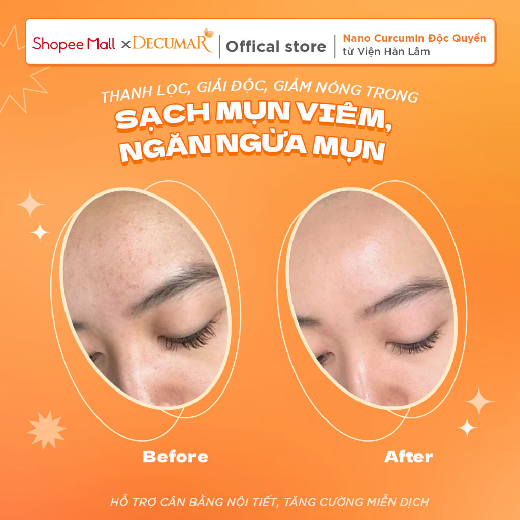 Viên uống Decumar Advanced ngừa mụn, giảm nhờn, 30 viên - VCM01 ...