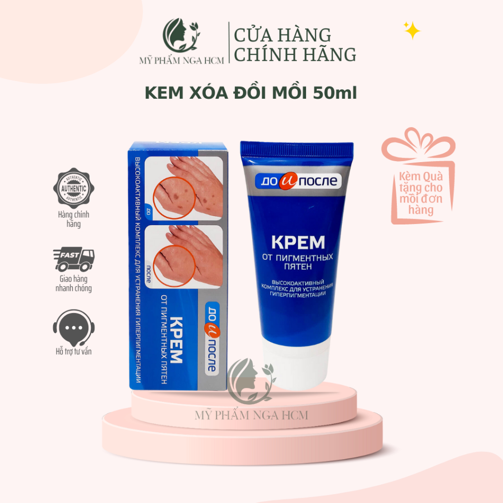 Kem chống đồi mồi Nga Kpem - Kem đồi mồi Before & After Anti-pigment ...